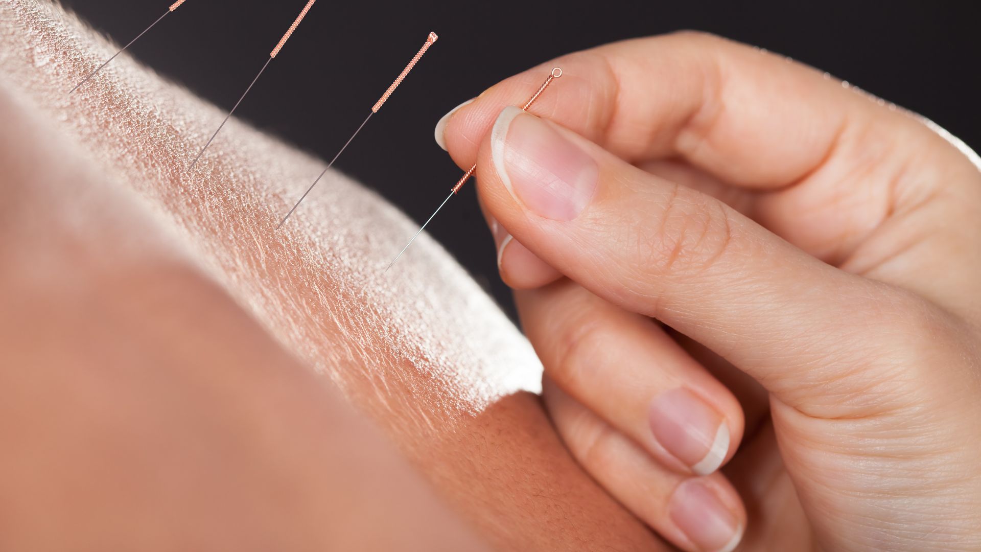 Ph.RICHARD: Acupuncture, Médecine Trad. Chinoise - Romans, près Valence ...